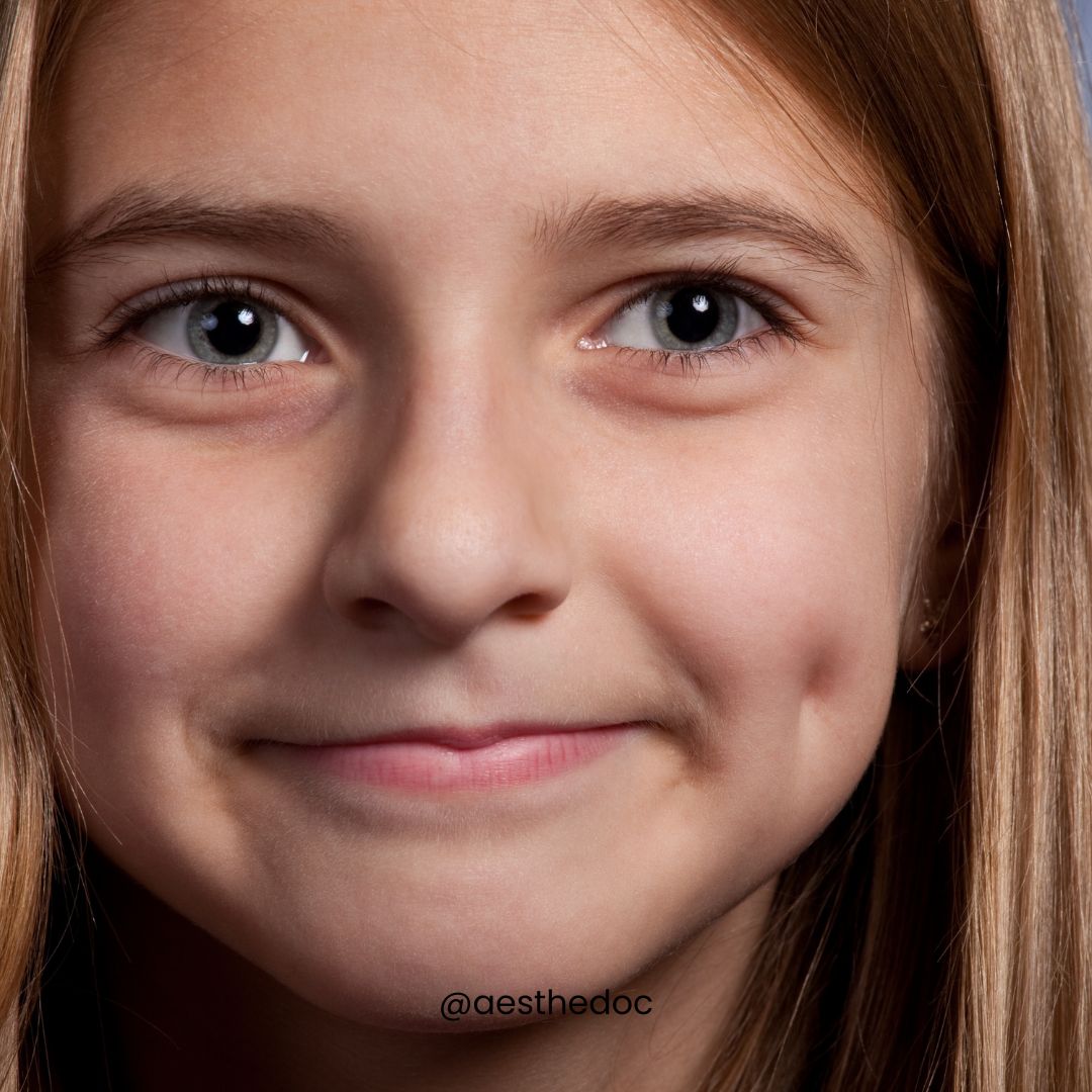 Dimple Creation in Lahore, Aesthedoc